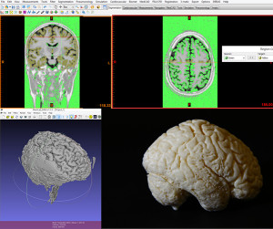 3D printed brain from neuro images – Neuro Memento Mori